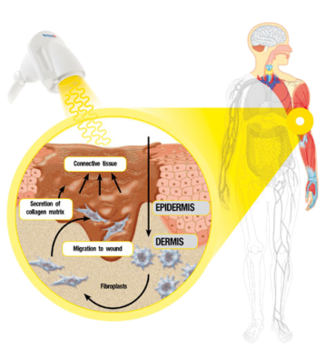 Unlock Healing with our BIOPTRON Light Therapy